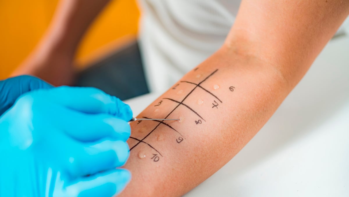 Does Cannabis Allergy Exist and How to Identify It's Symptoms | Fast Buds