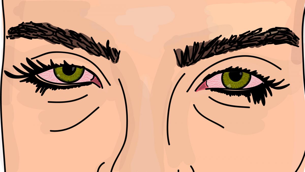 The Weed Dictionary: Stoners' Slang Explained | Fast Buds